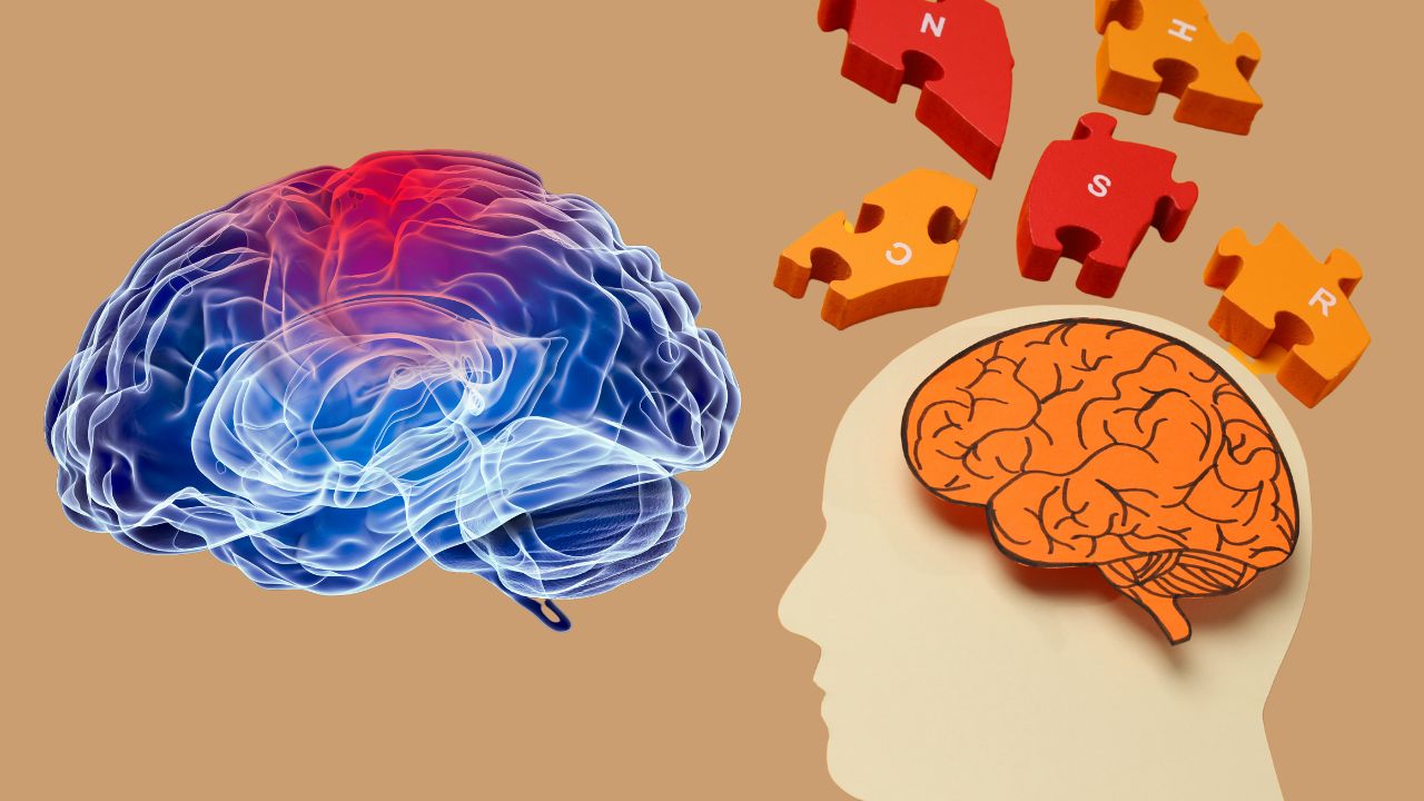 Amnesia Brain Vs Normal Brain